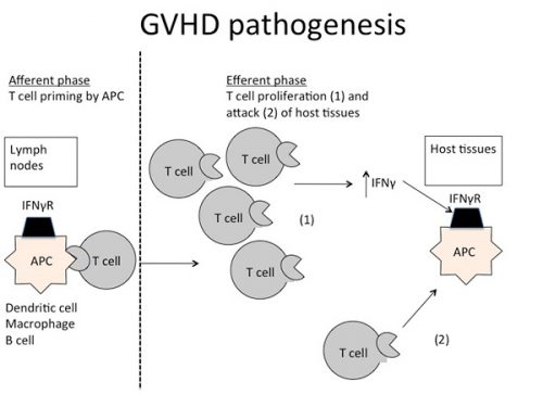 Graft-versus-host-disease (GVHD) – Department of Pediatrics – UW–Madison