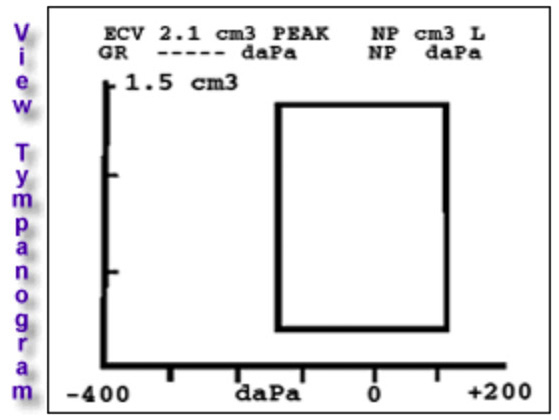 Tympanometry – Department of Pediatrics – UW–Madison