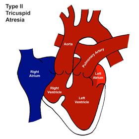 Congenital Heart Diseases – Department of Pediatrics – UW–Madison