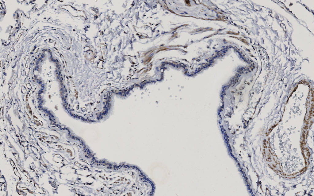 James Gern, MD, awarded U19 opportunity funds from NIAID – Department ...